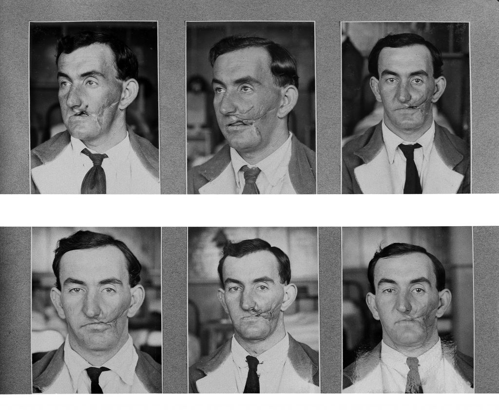 Plastic Surgery - Mattrix Hospital